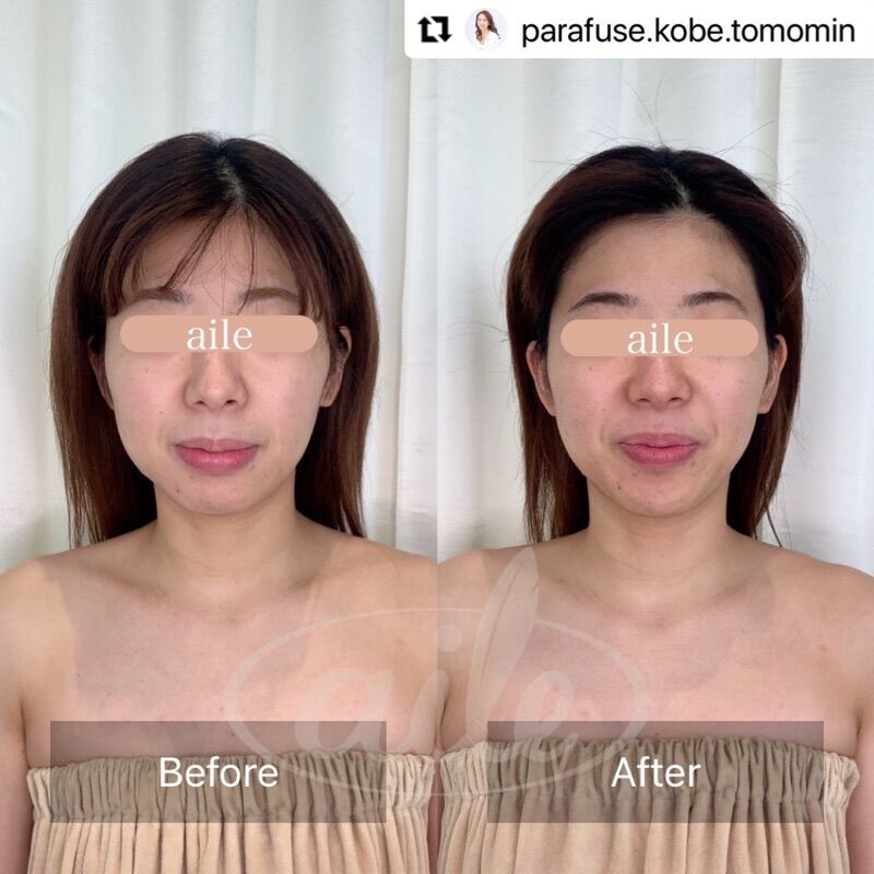 [PARAFUSE.脳洗浄®]Before→After★*° | 神戸で培ったエステに関する専門知識をわかりやすく発信します